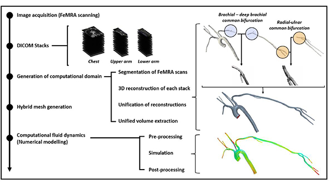 Using hemodynamic modeling to improve dialysis patients’ chances of success