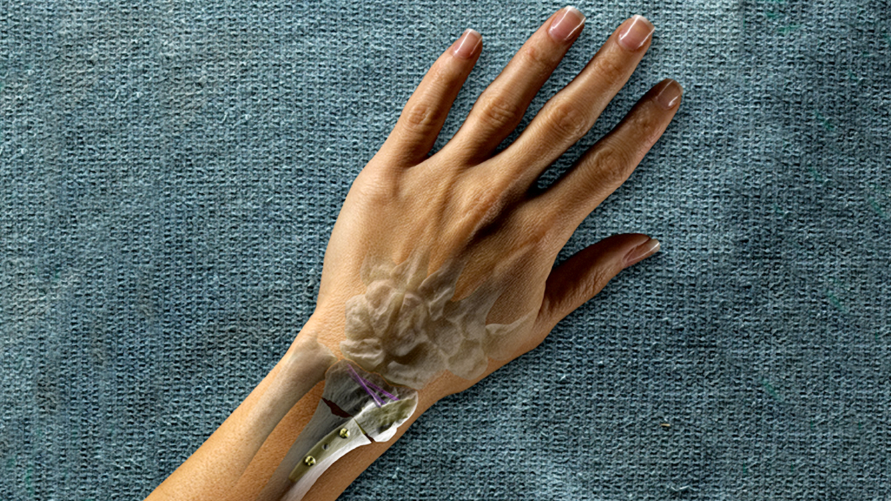 Wright Medical Technology